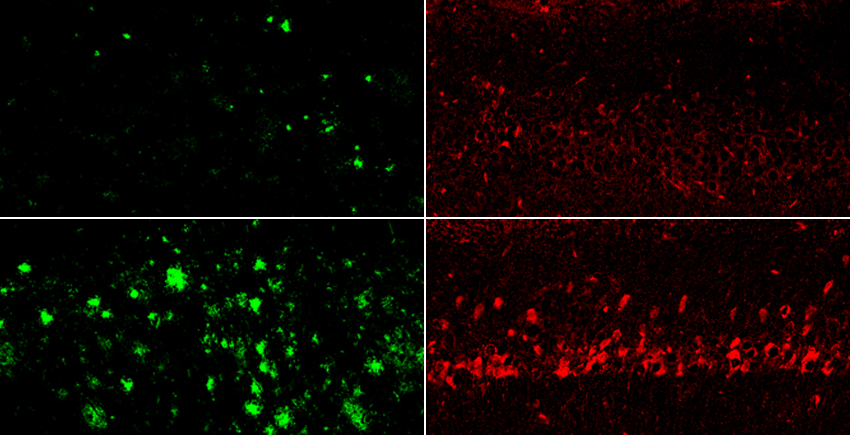 Could Lithium Explain — and Treat — Alzheimer’s Disease? | Harvard ...